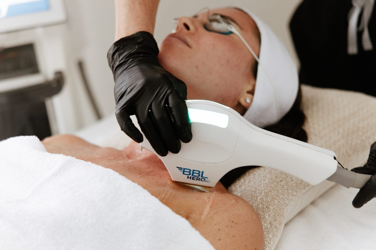 mJOULE – BBL Heroic and Moxi - Bobbi Bullock Medical Esthetics